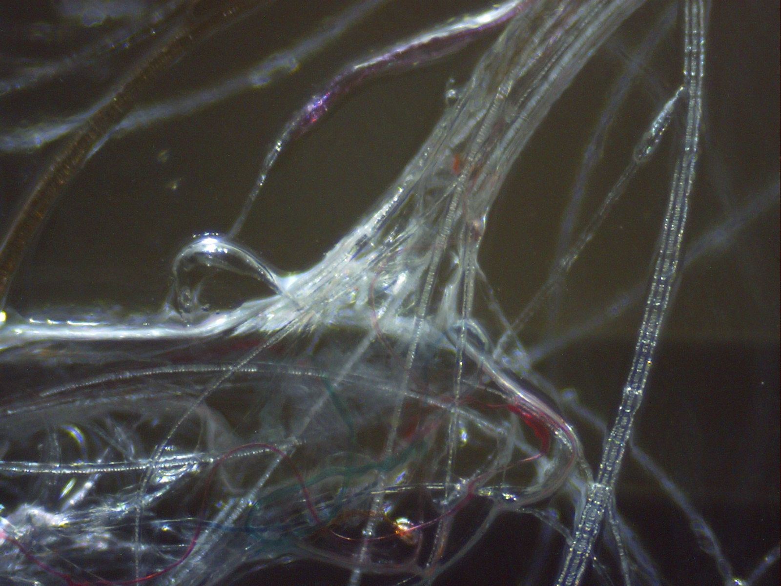 Morgellons Disease – A New Autoimmune Disease?